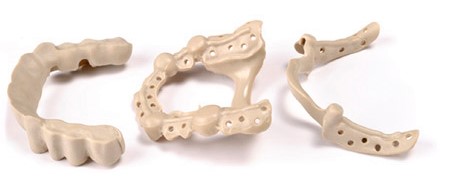 » Permanent Prosthesis for Implants