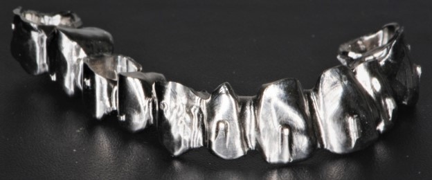 » Permanent Prosthesis for Implants